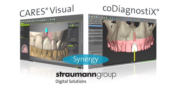 Straumann® Guided Surgery